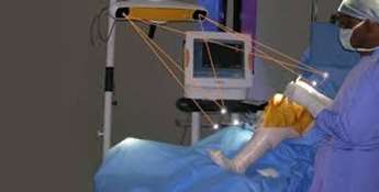 Navigation Total Knee Replacement | Mumbai | India | Dr Chirag Patel